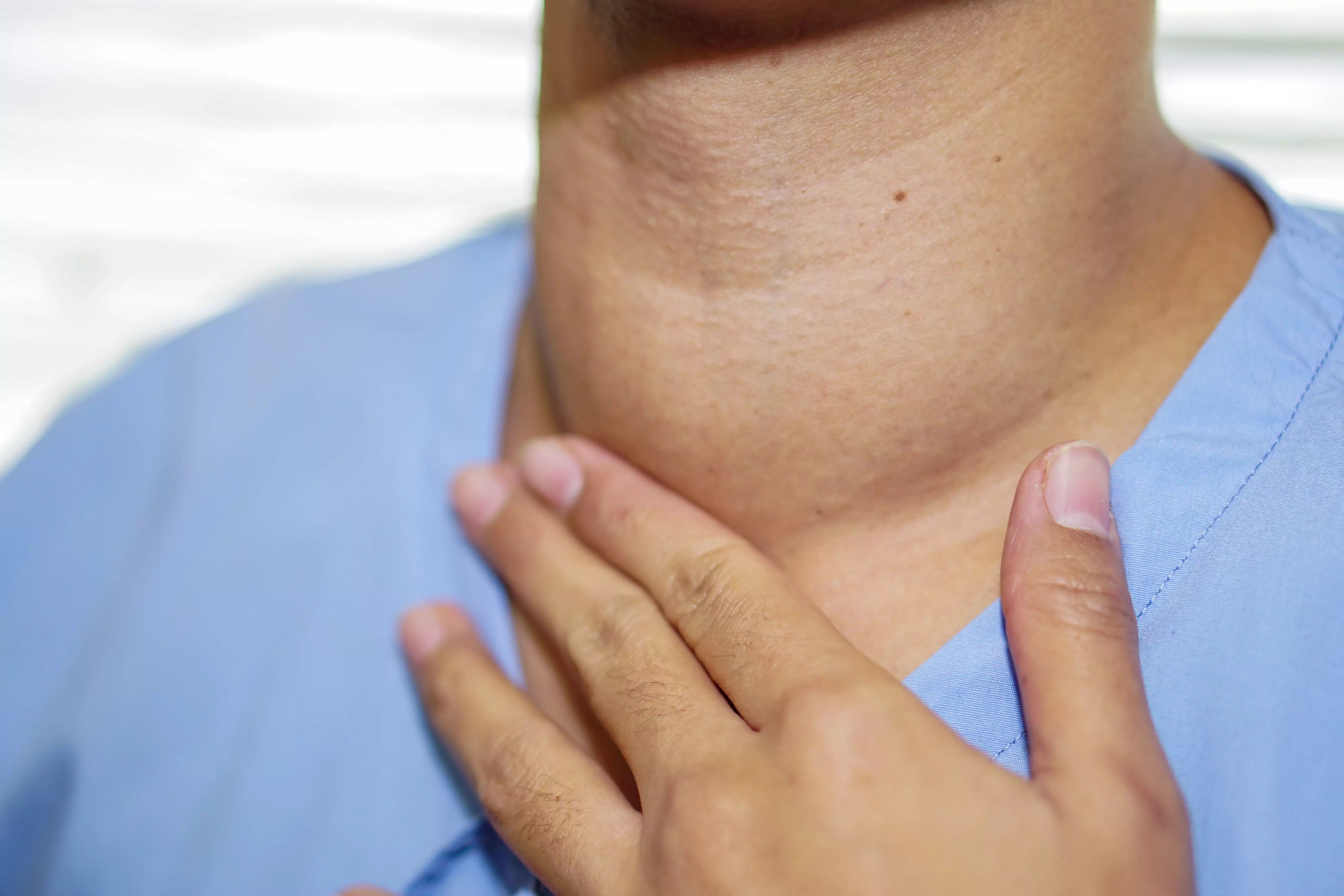 Goiter: Causes, Symptoms, and Solutions | Meri Sehat