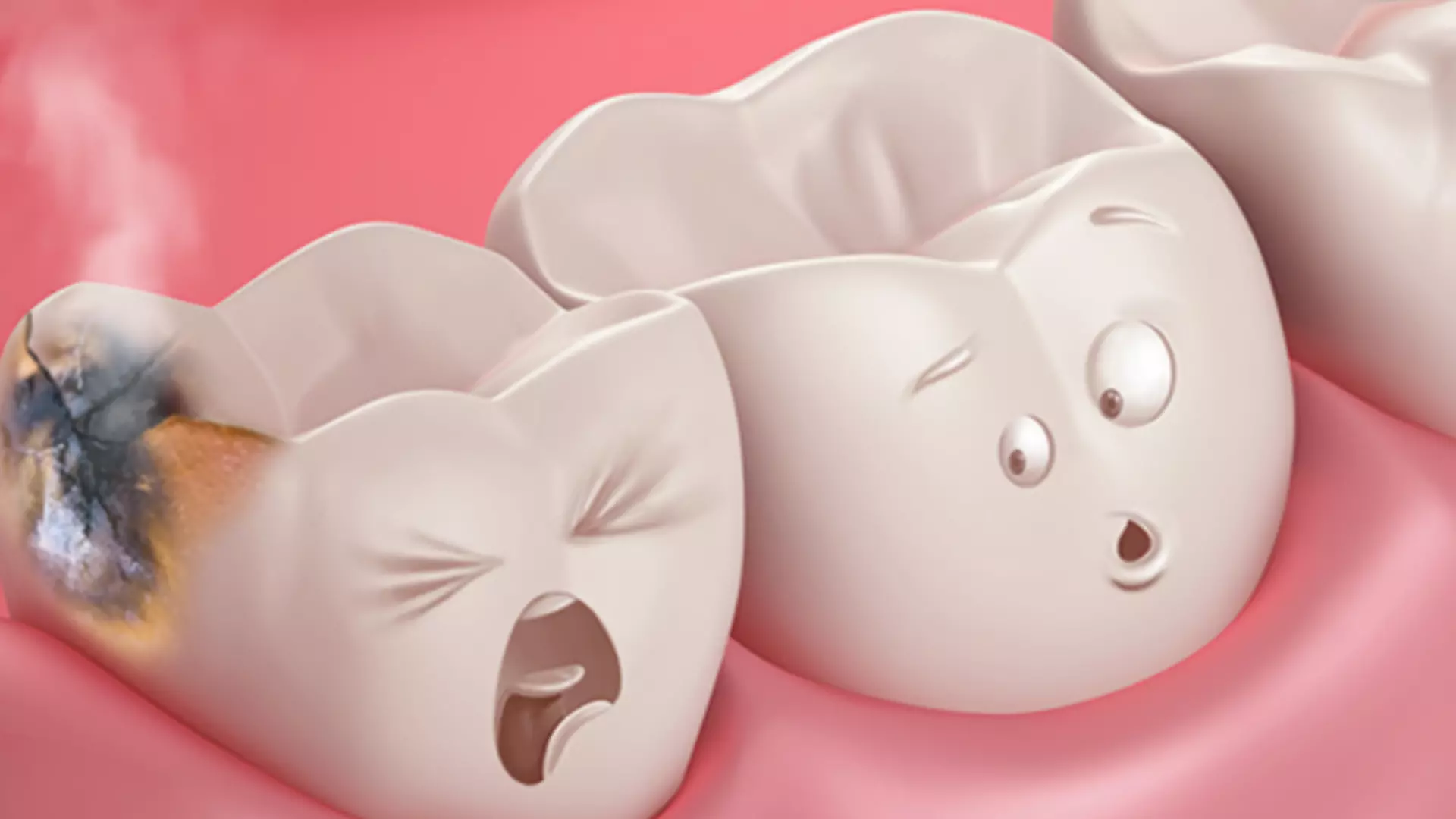 Protect Your Smile:Understanding Tooth Decay and Prevention|Meri Sehat