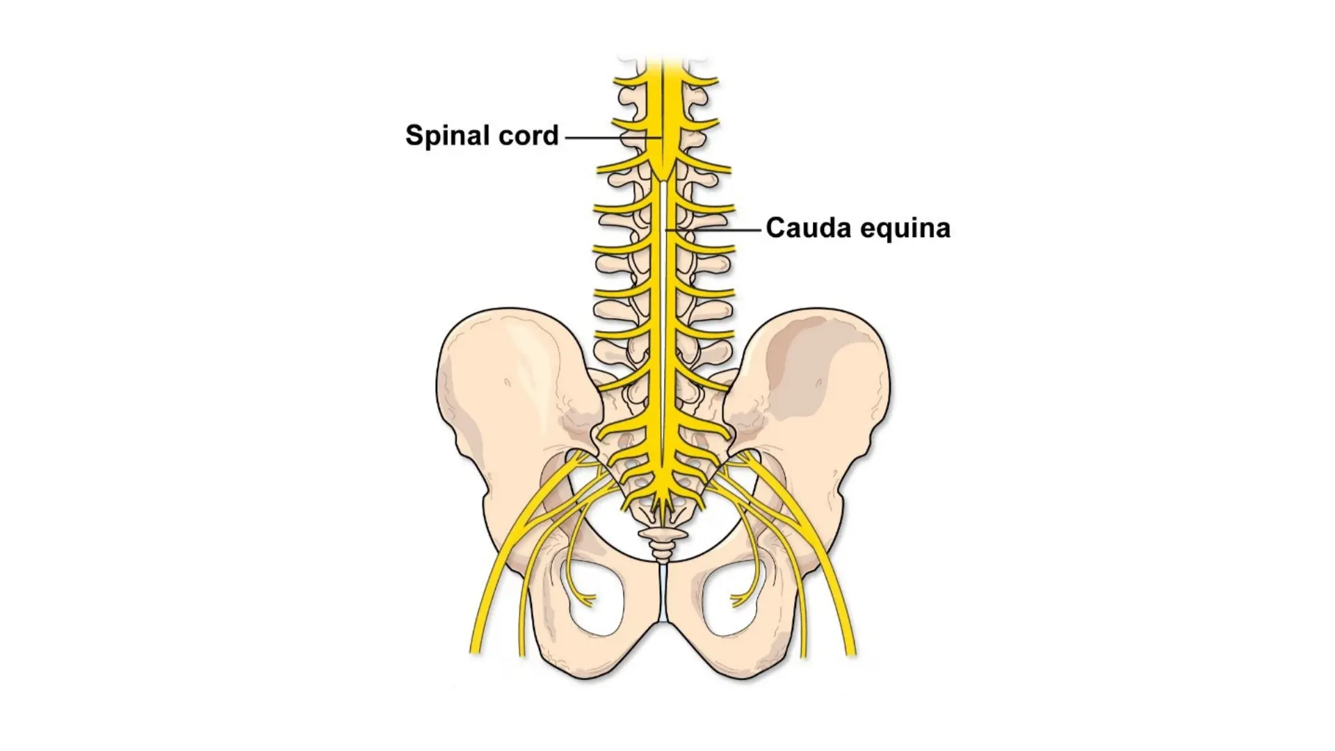 Understanding Cauda Equina Syndrome | Meri Sehat