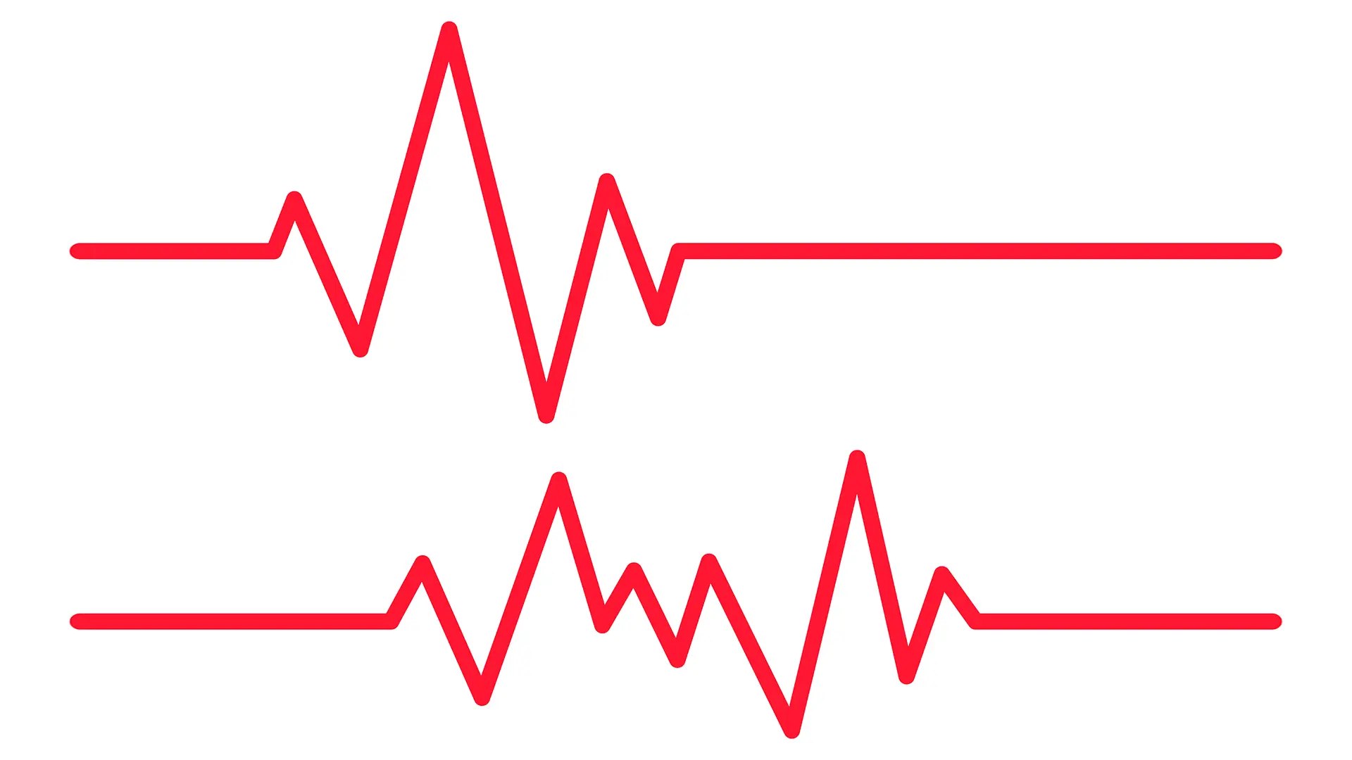 Heart Rhythms Unveiled: Understanding Arrhythmia | Meri Sehat