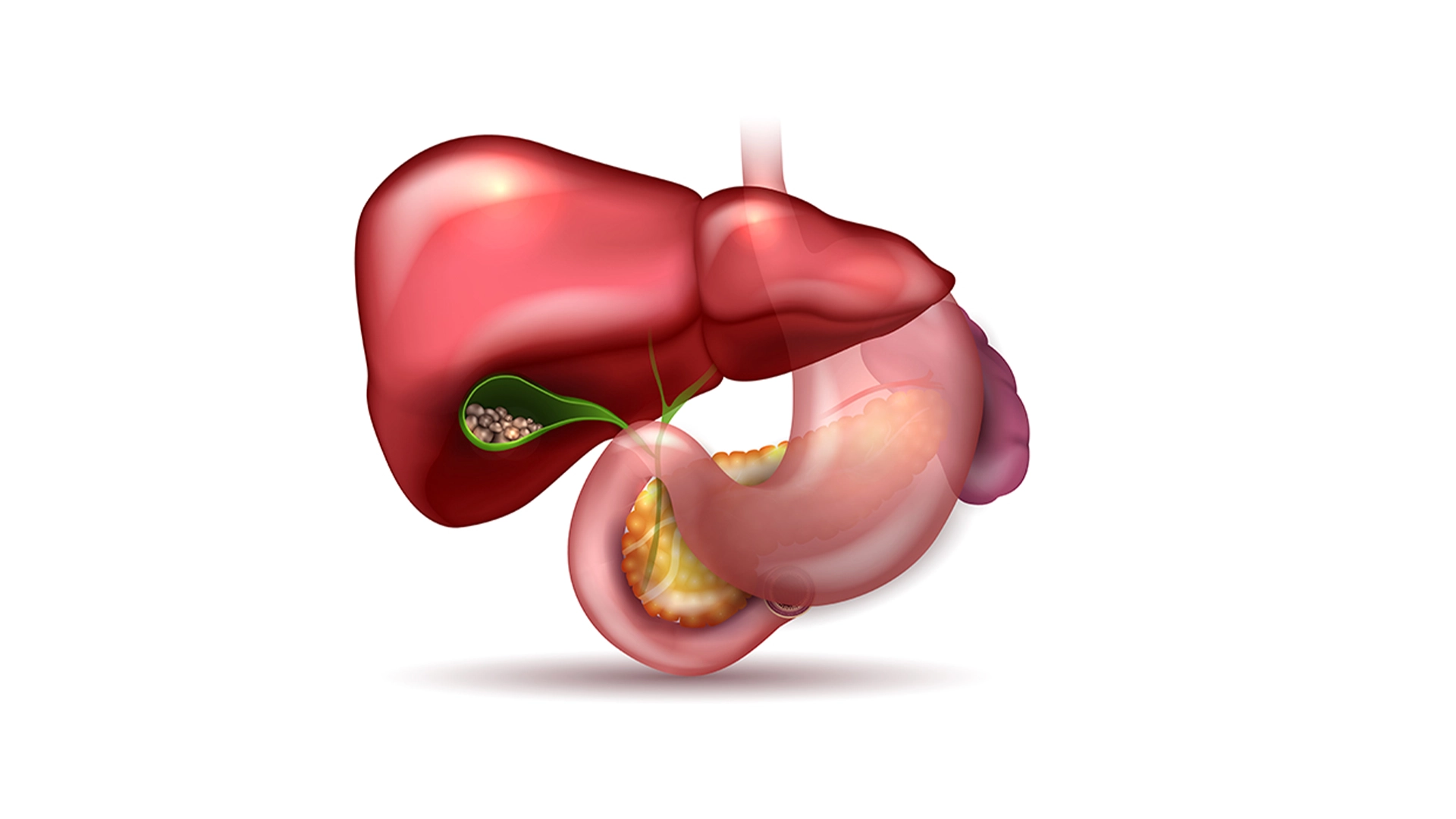 Cholecystitis | Causes, Symptoms, and Treatment | Meri Sehat
