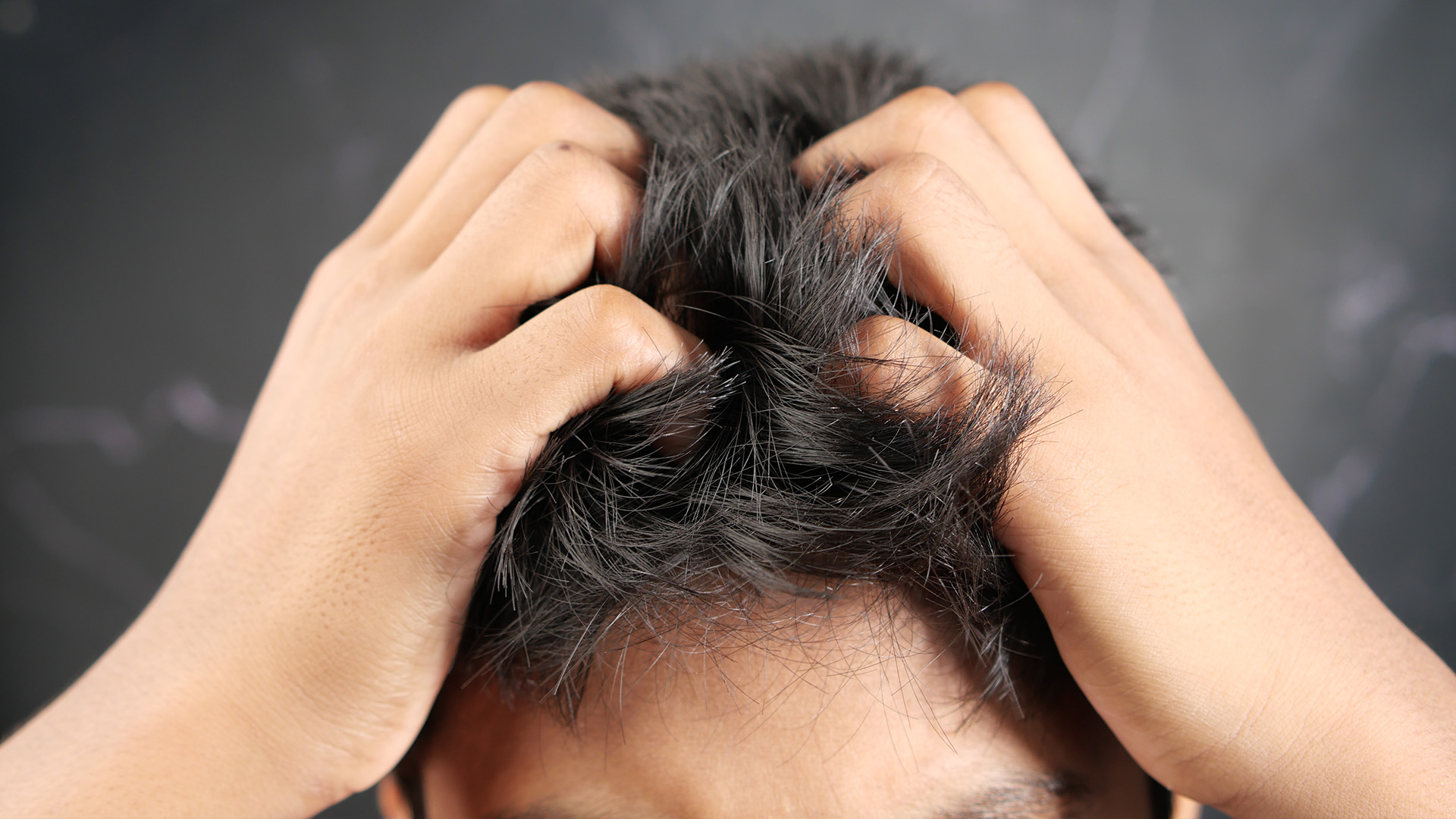 Head Lice: Causes, Treatment, and the Best Solution