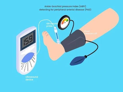 Why You Might Need Your Blood Pressure Taken In The Leg | Meri Sehat
